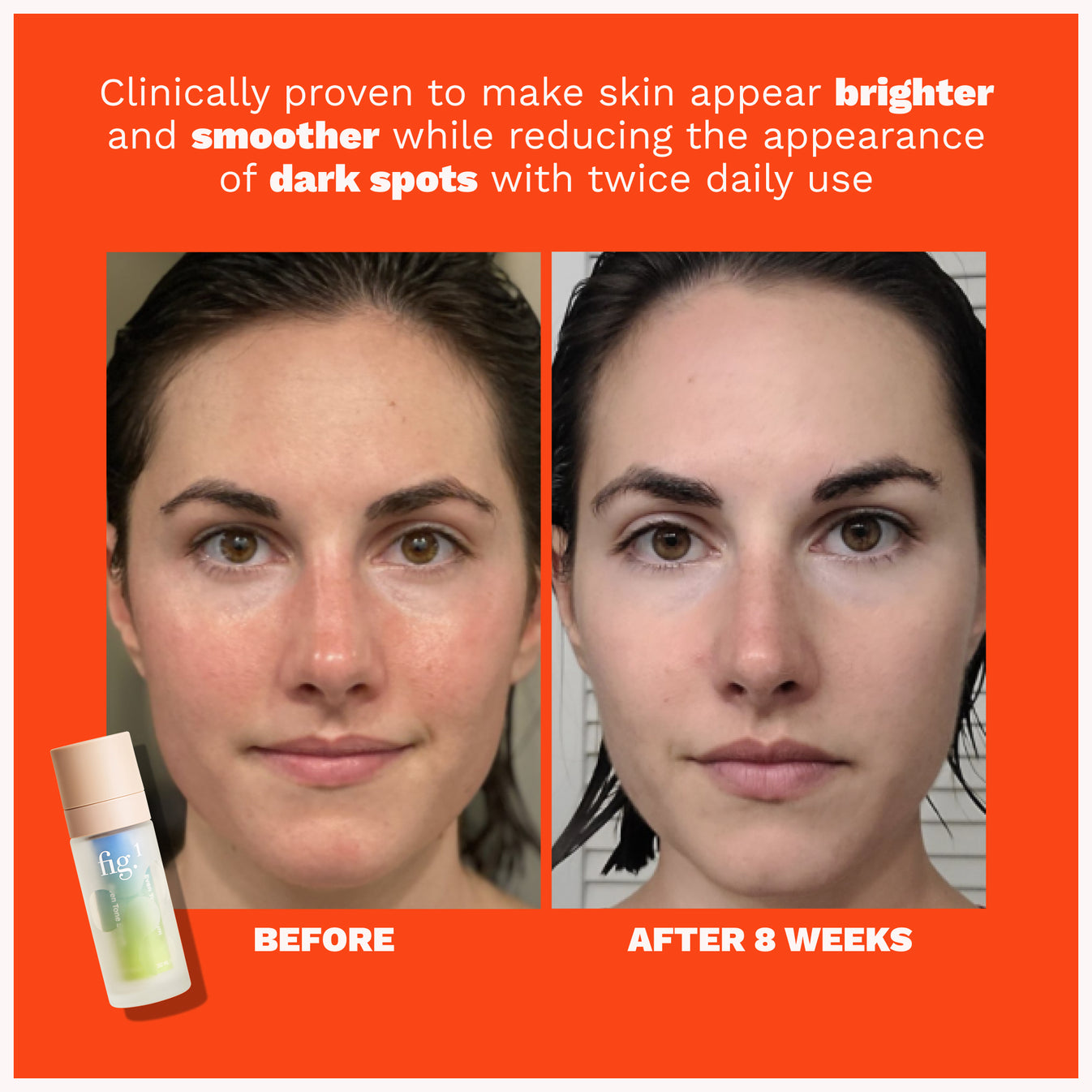 Even Tone Serum – Fig.1 Beauty